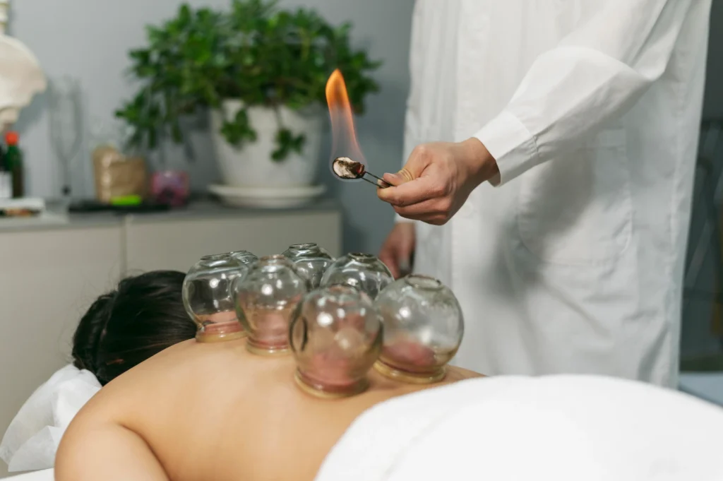 Dynamic Cupping Therapy Dr Ashish Tomar
